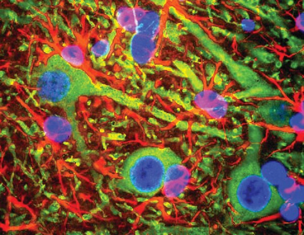 Anti-Microtubule-Associated Protein 2 (MAP2) Antibody | AB5622